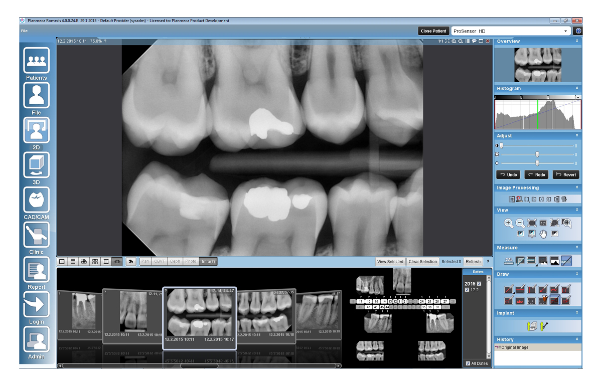 Planmeca ProSensor HD - Henry Schein Equipment New Zealand