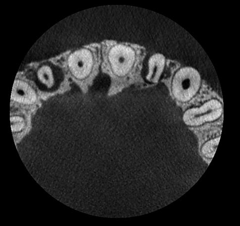 Planmeca Planmeca Viso CBCT - Henry Schein Equipment New Zealand